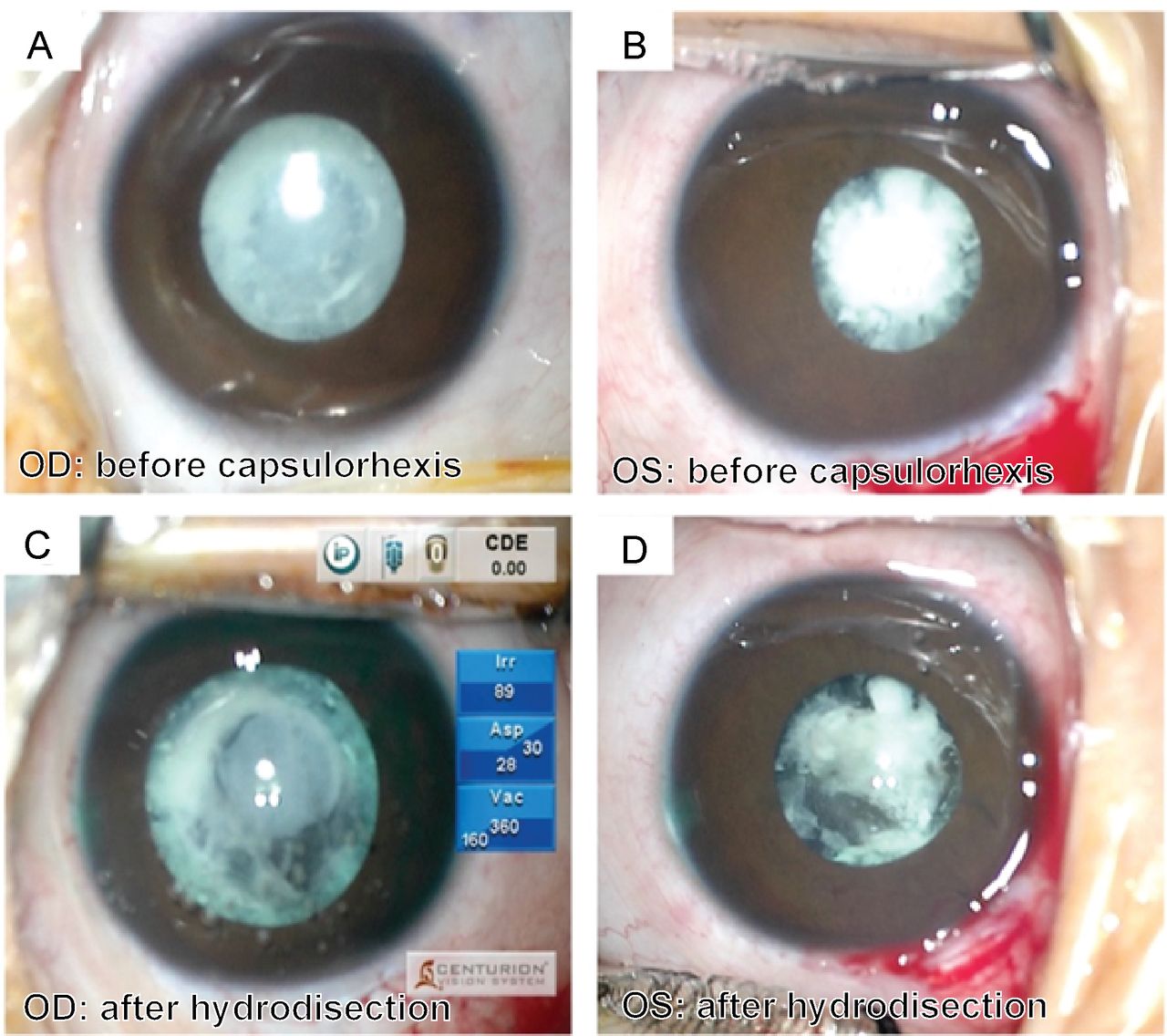 Deep learning–based assessment of missense variants in the COG4 gene ...