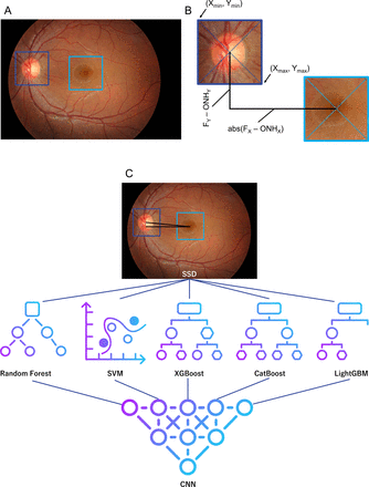 Development of a cloud-based estimator for analysing the disc–fovea ...