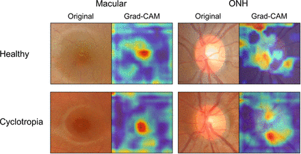 Development of a cloud-based estimator for analysing the disc–fovea ...
