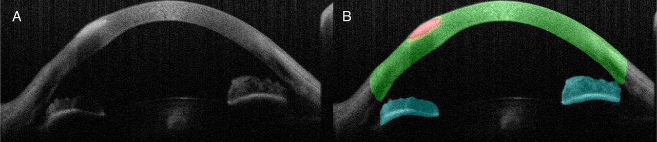 AI-MK: artificial intelligence for assessing and monitoring microbial ...