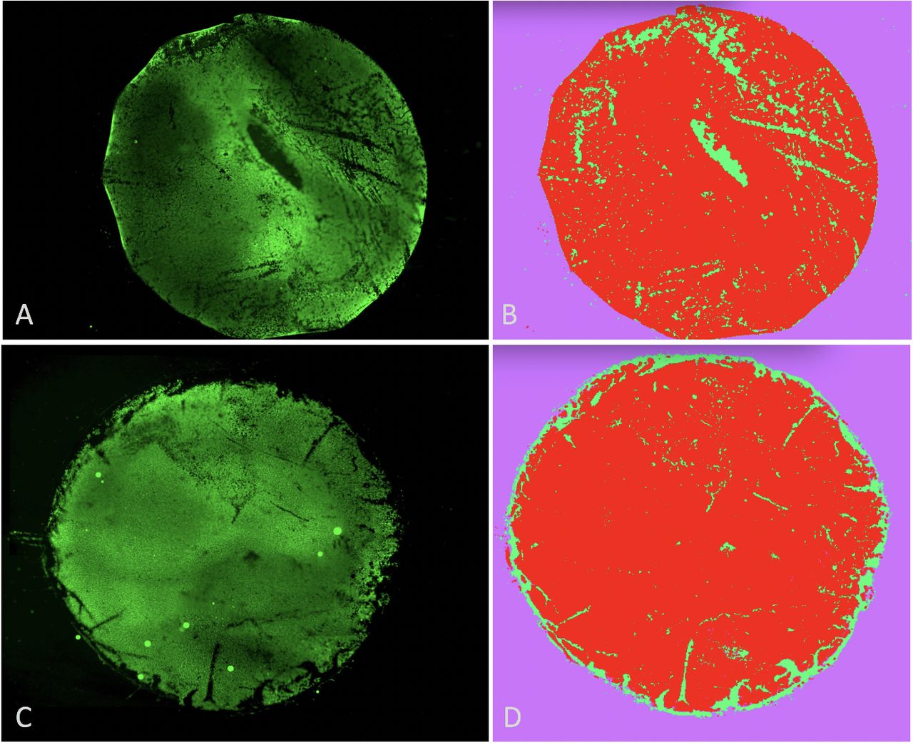 Viability of preloaded Descemet membrane endothelial keratoplasty ...