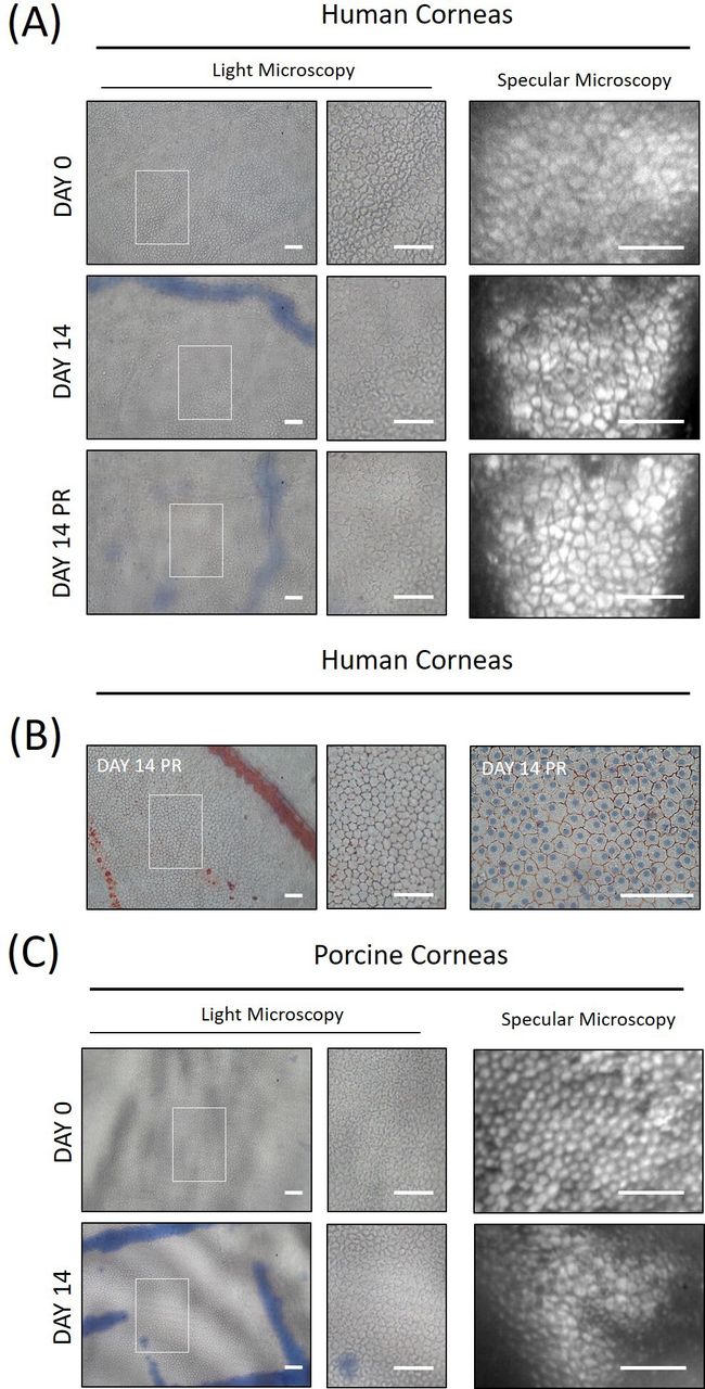 Assessment of performance and safety of Corneal Chamber hypothermic ...
