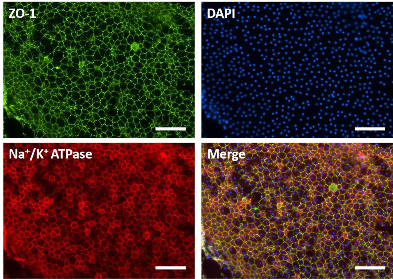Assessment of performance and safety of Corneal Chamber hypothermic ...