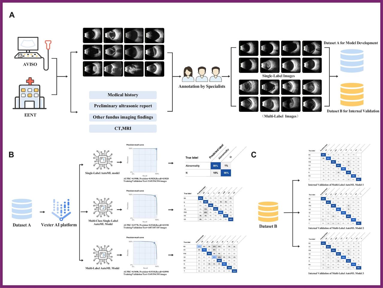 Performance of automated machine learning in detecting fundus diseases ...